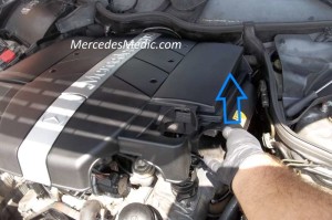 engine cover remove – MB Medic